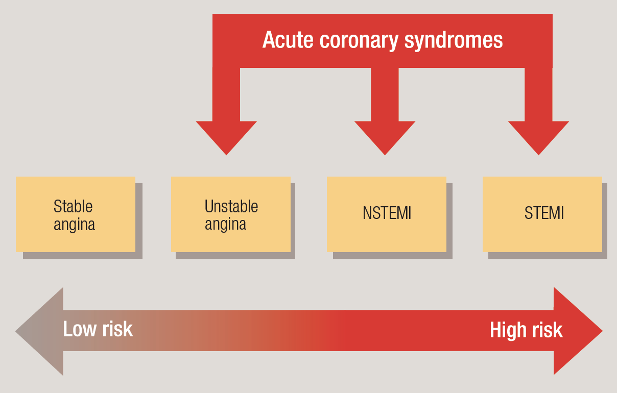 Acute coronary syndromes - Issues and Answers