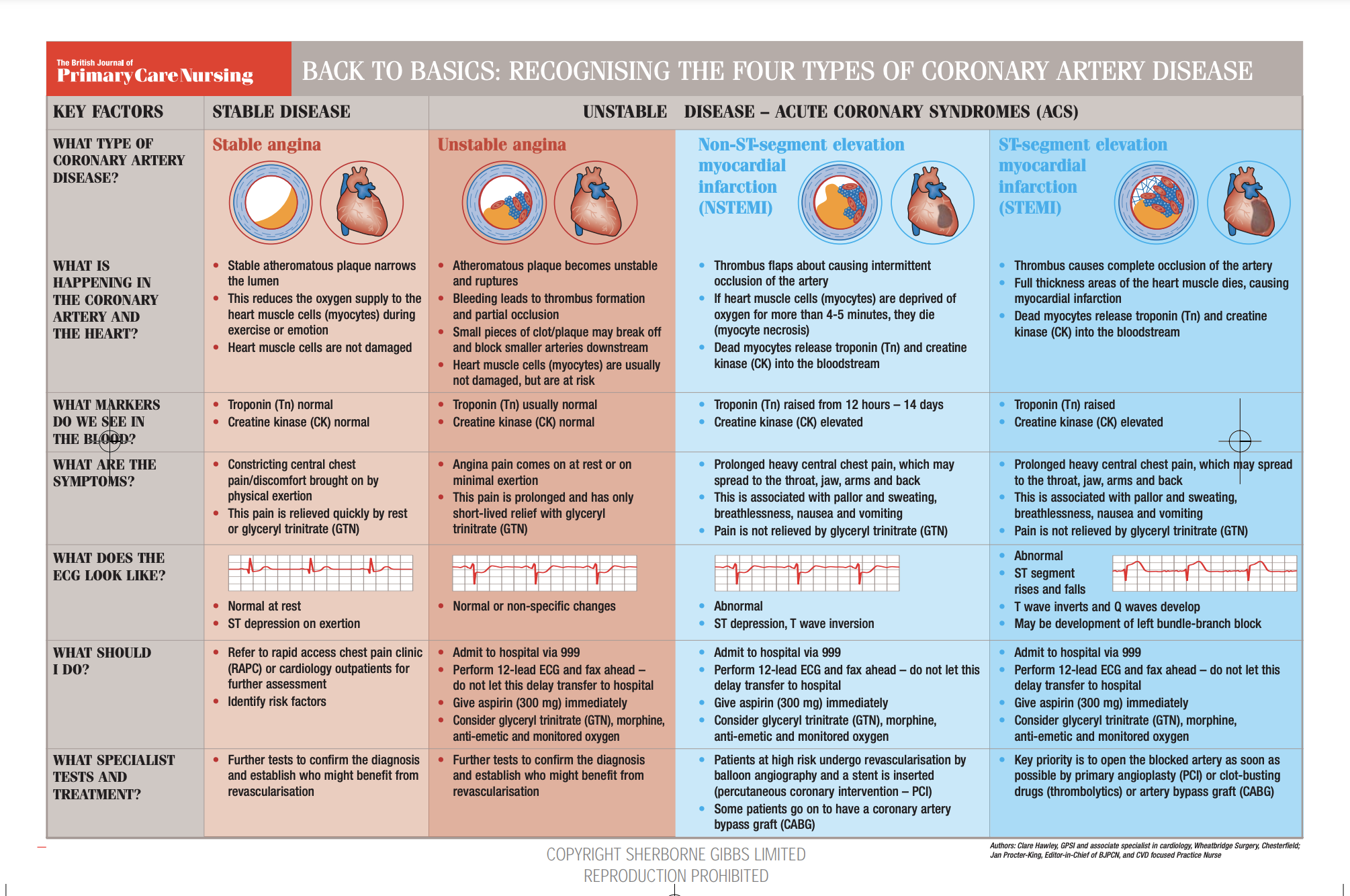 Back to Basics: Recognising the four types of coronary artery disease ...