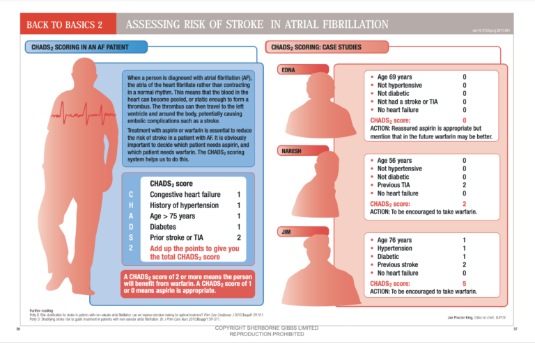 Back to Basics: Assessing risk of stroke in atrial fibrillation ...