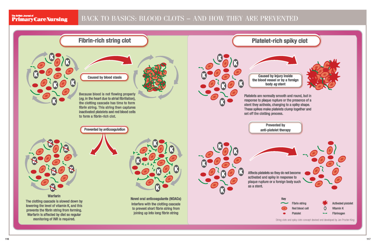 Back to Basics: Blood clots and how they are prevented - Issues and Answers