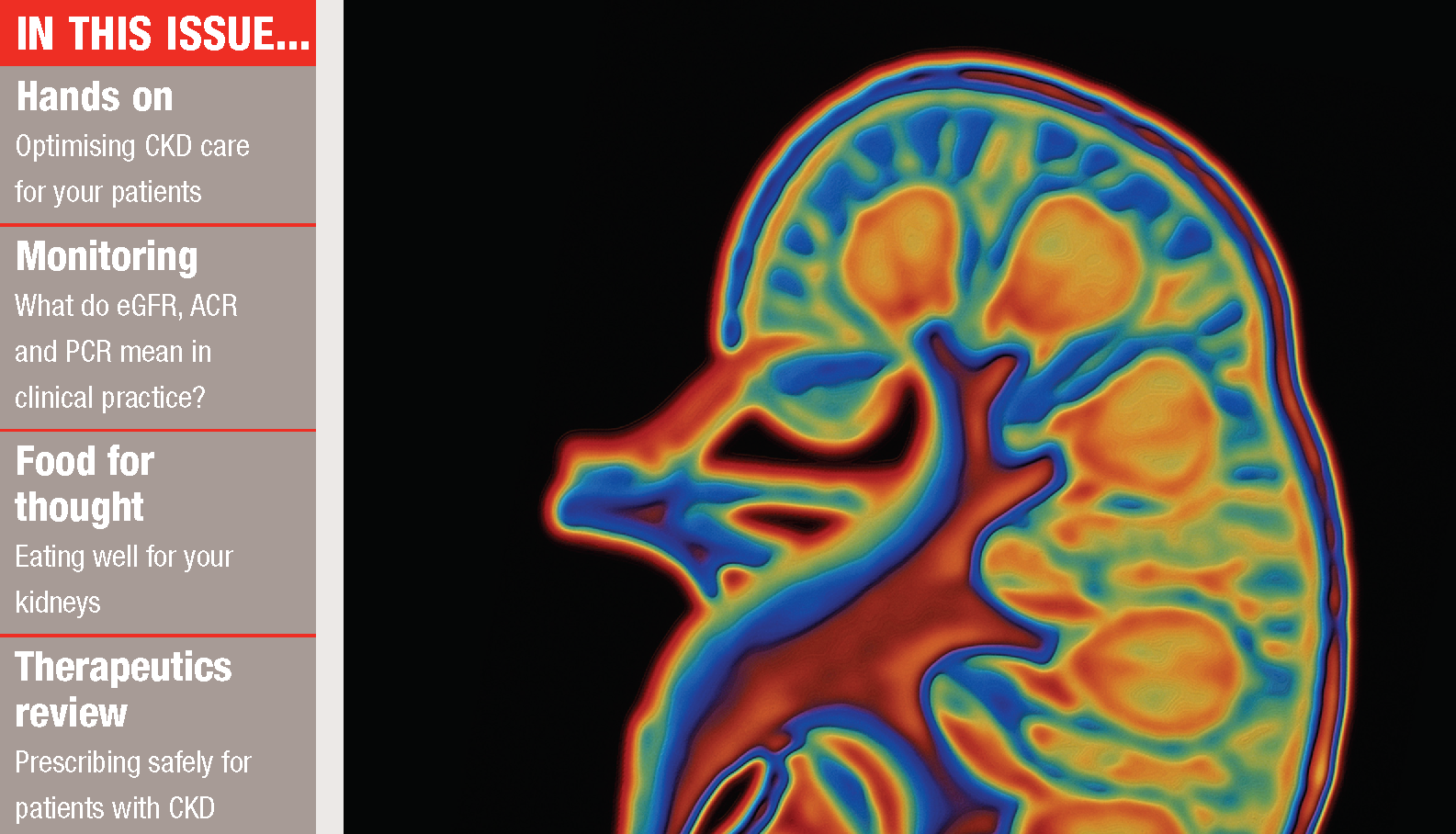 Chronic kidney disease: Helping practices to identify patients at risk ...