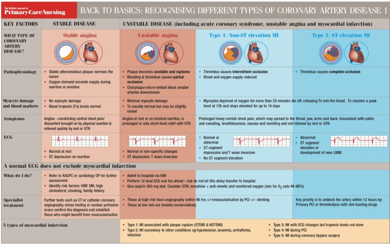 Back to Basics: Recognising different types of coronary artery disease ...