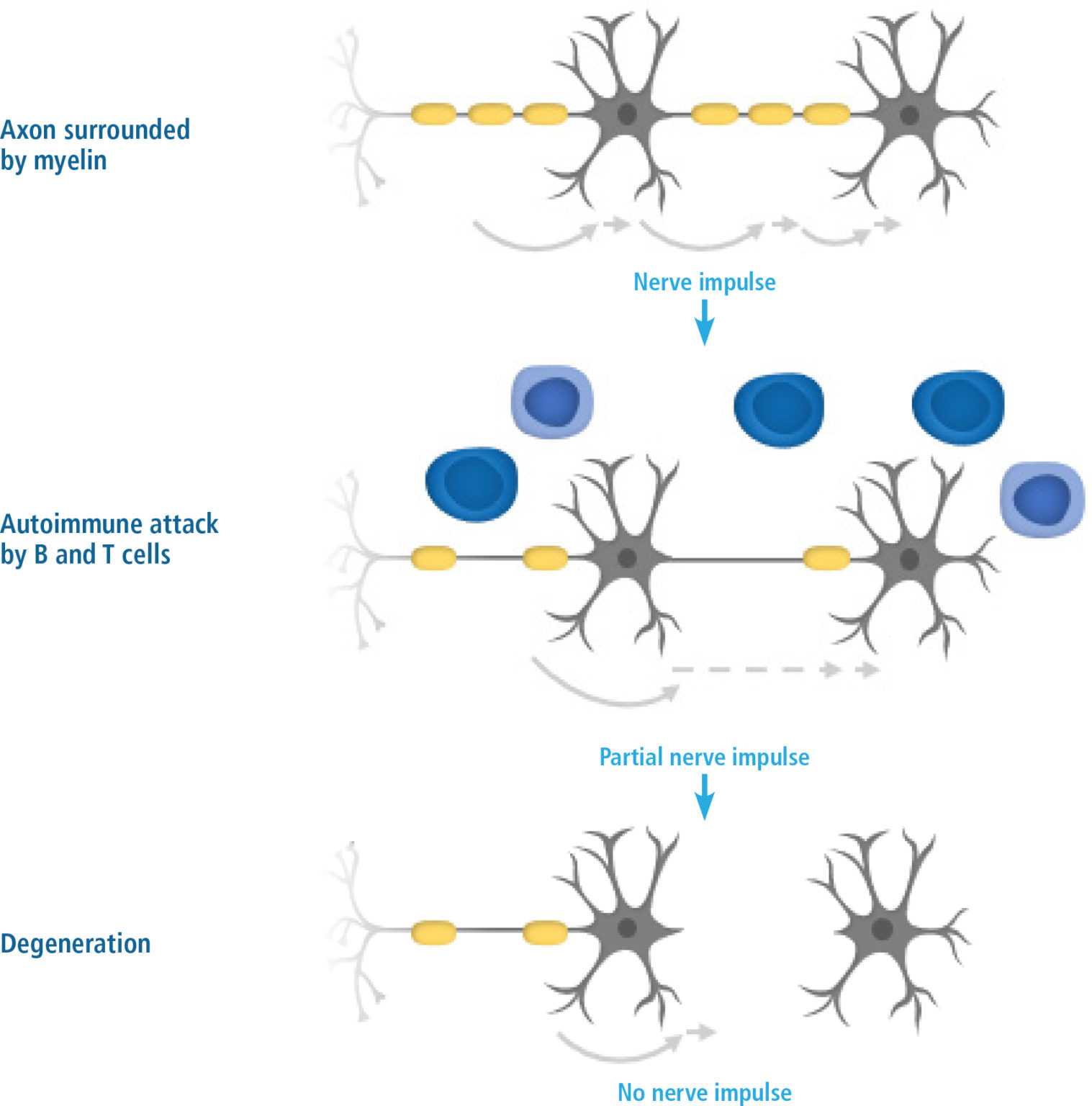 Multiple sclerosis in primary care – diagnosis and early treatment ...