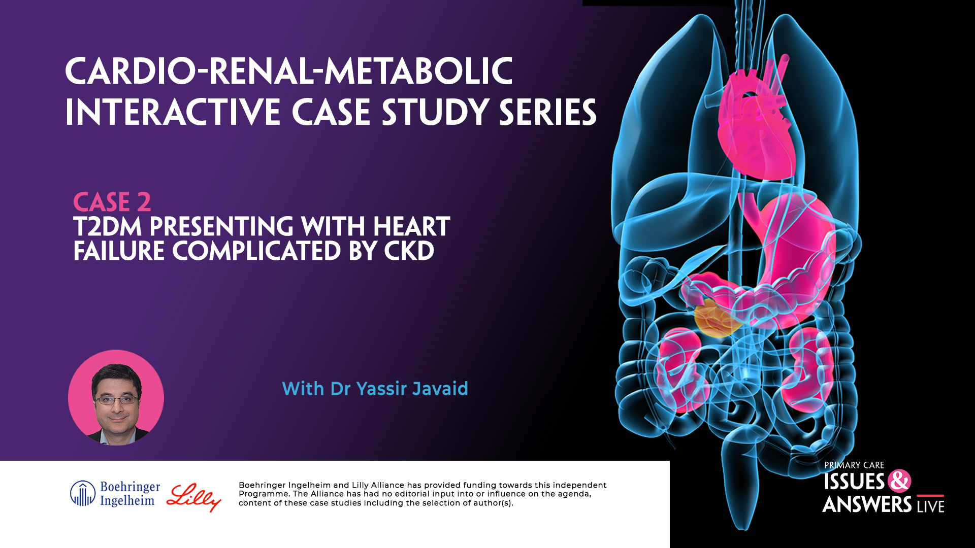 CRM Case Study Series - Case 2: T2DM presenting with heart failure complicated by CKD ...