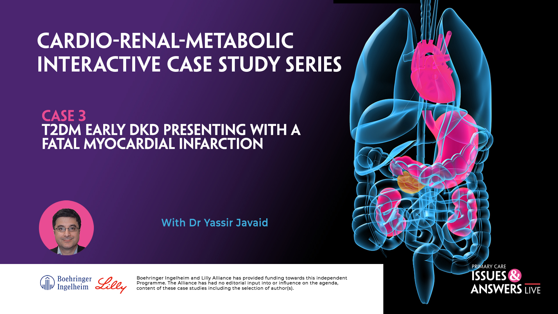 CRM Case Study Series - Case 3: T2DM and early DKD presenting with a ...