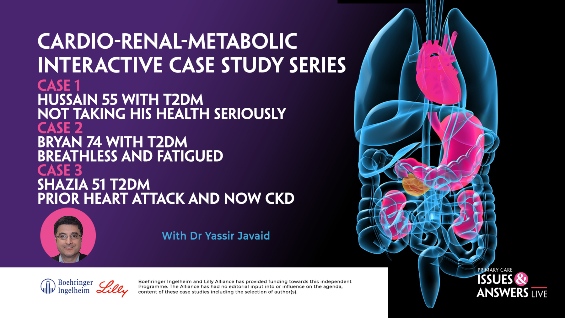 CRM Case Study Series - Issues and Answers